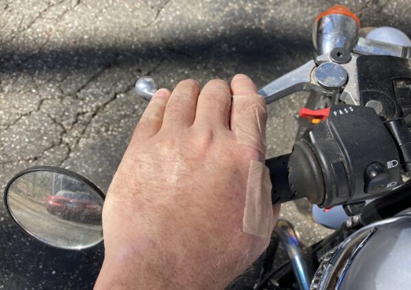 Riding Season Delayed By Traumatic Accident WIth Log Splitter